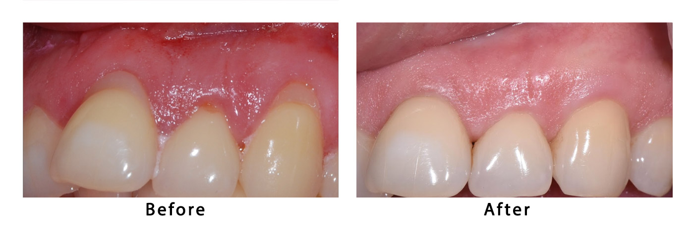 Photos – Perio Toledo | Toledo Periodontist